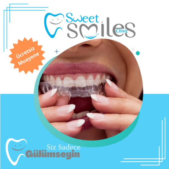 Sweet Smiles Clinic – Sweet Smiles Clinic